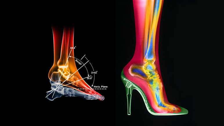 Chiropody/Reflexology/Podiatry/Bio-Mechanics & Orthotics Clinic Hayes ...